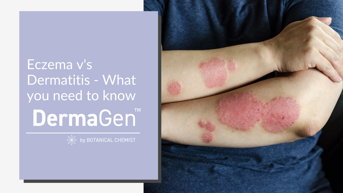 Eczema v's Dermatitis - What you need to know – DermaGen by Botanical ...