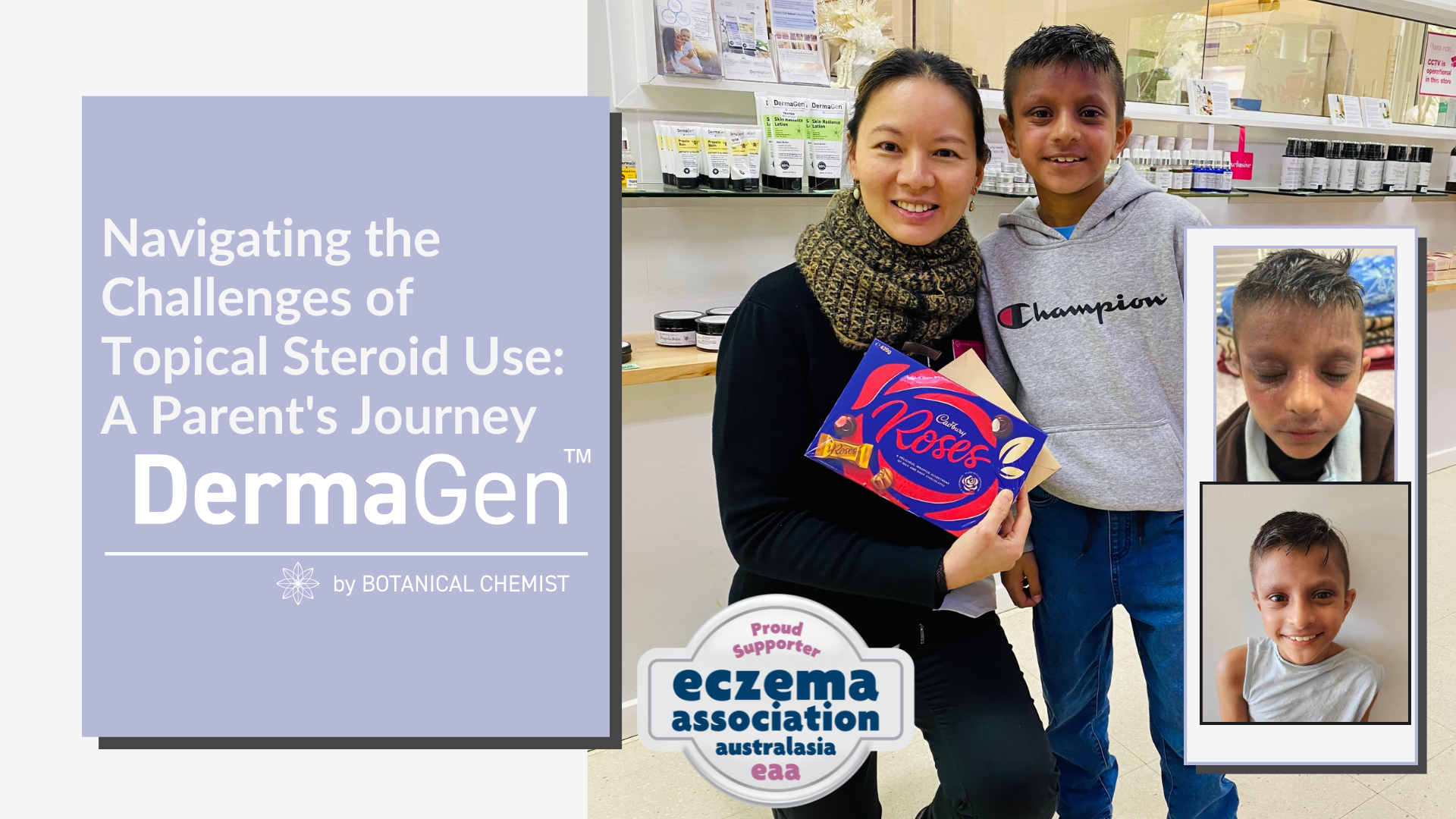 Navigating the Challenges of Topical Steroid Use: A Parent's Journey ...