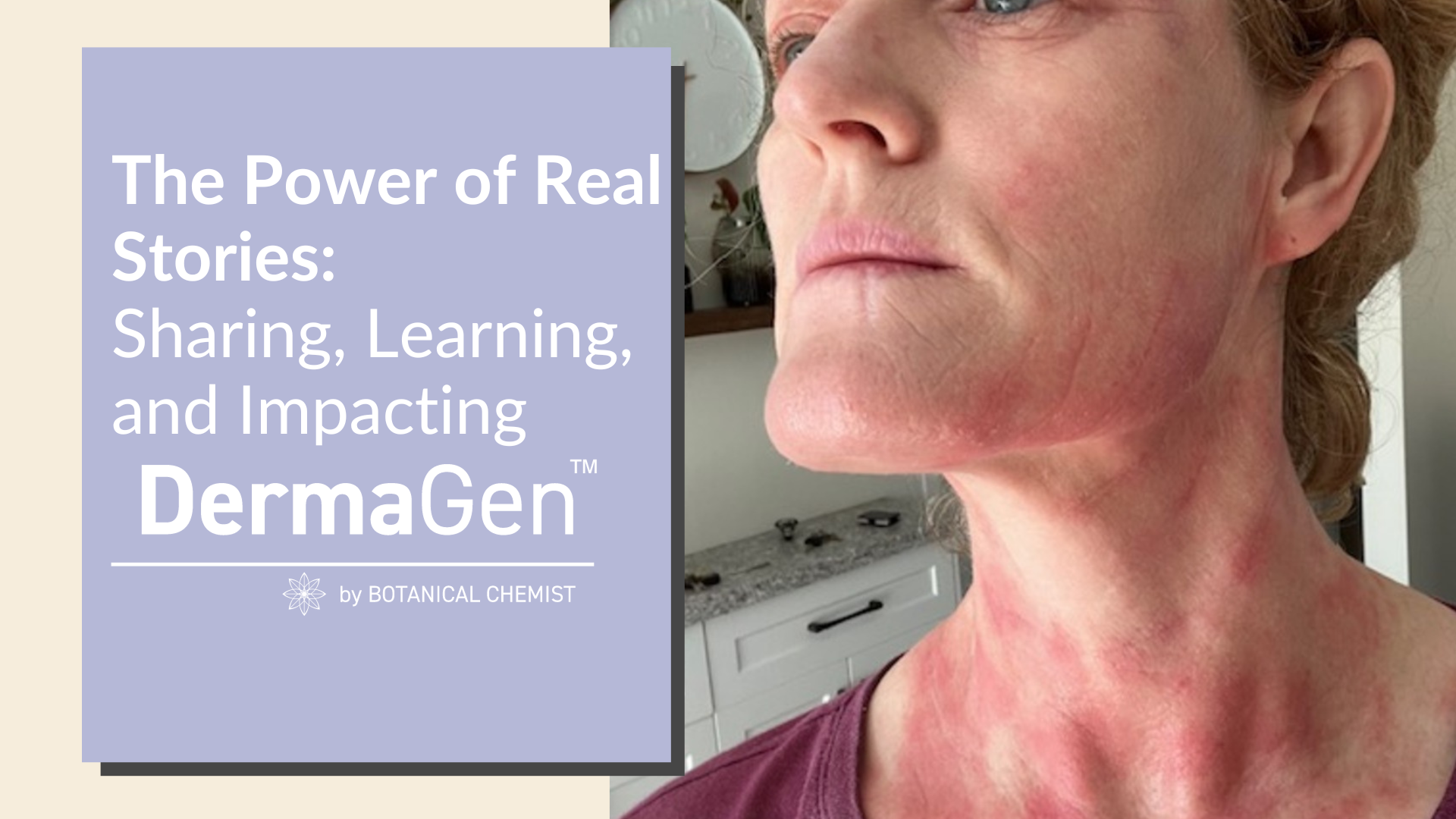 The Power of Real Stories: Sharing, Learning, and Impacting – DermaGen ...